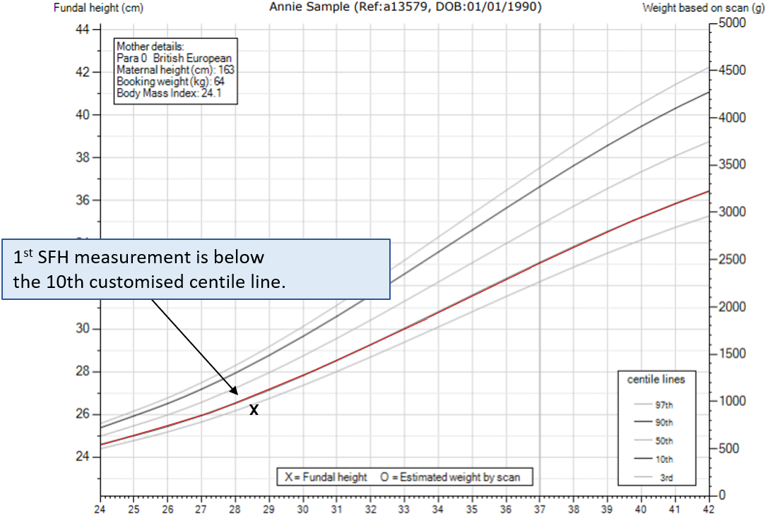 Perinatal Institute: Examples